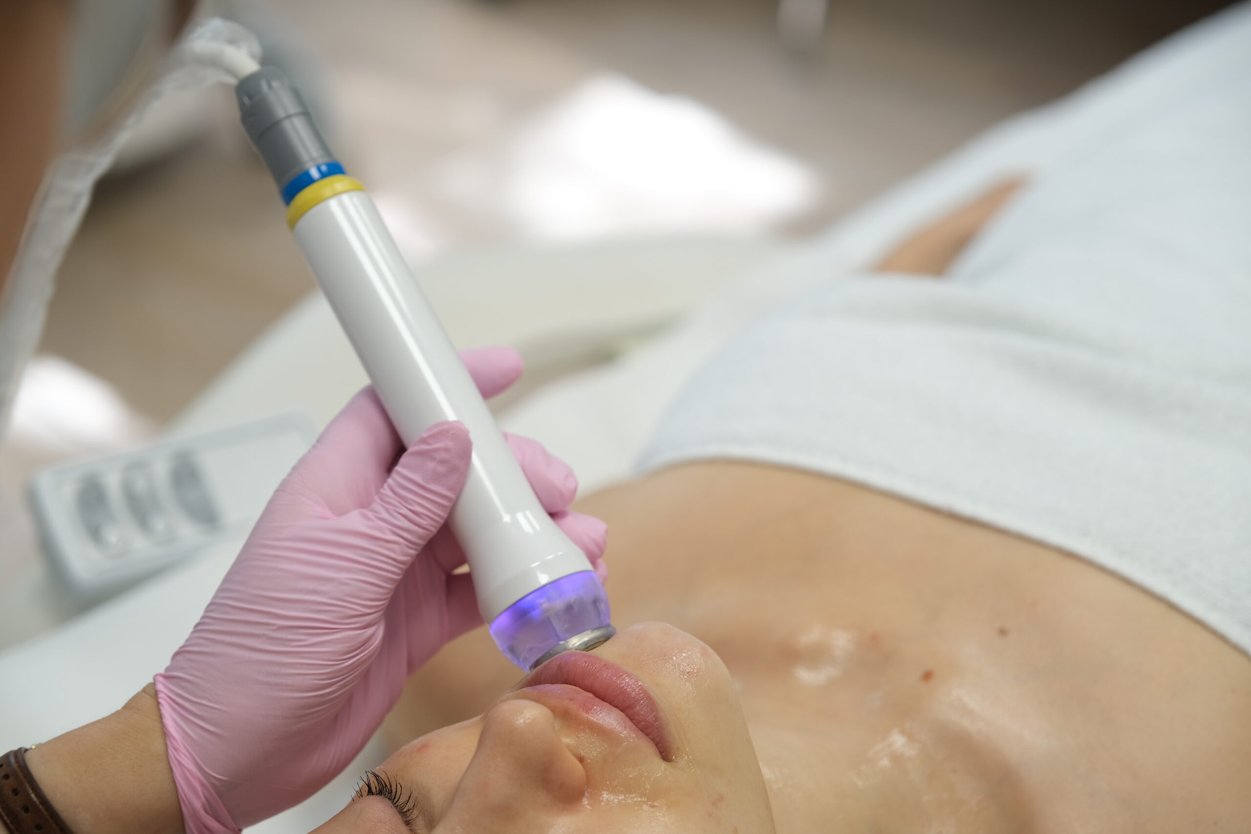 Epilarea Definitivă cu Laser Femei - Natura Laser Bacau & Oradea